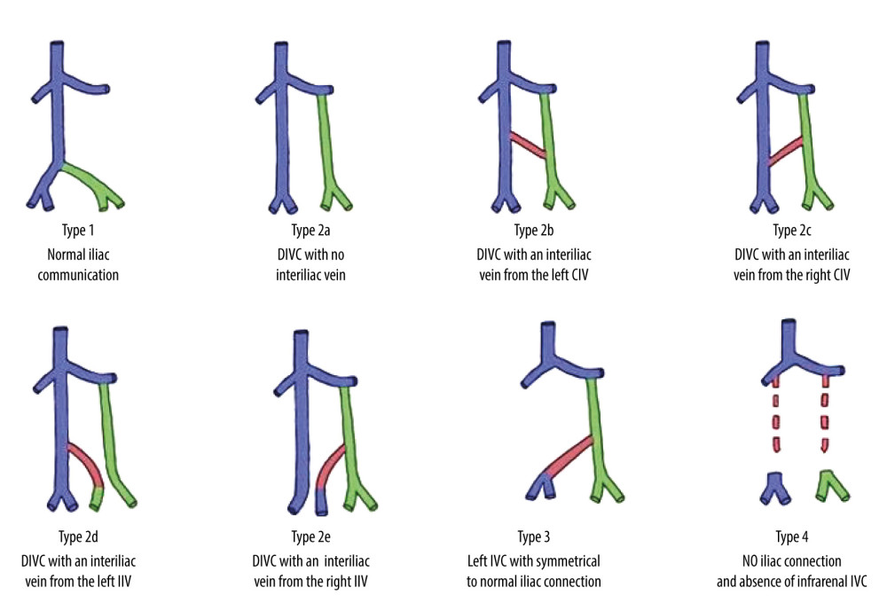 American Journal of Case Reports | Blunt Abdominal Trauma Leading to an ...