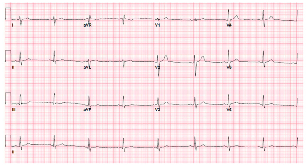 American Journal of Case Reports | Longitudinal Follow-Up of ...