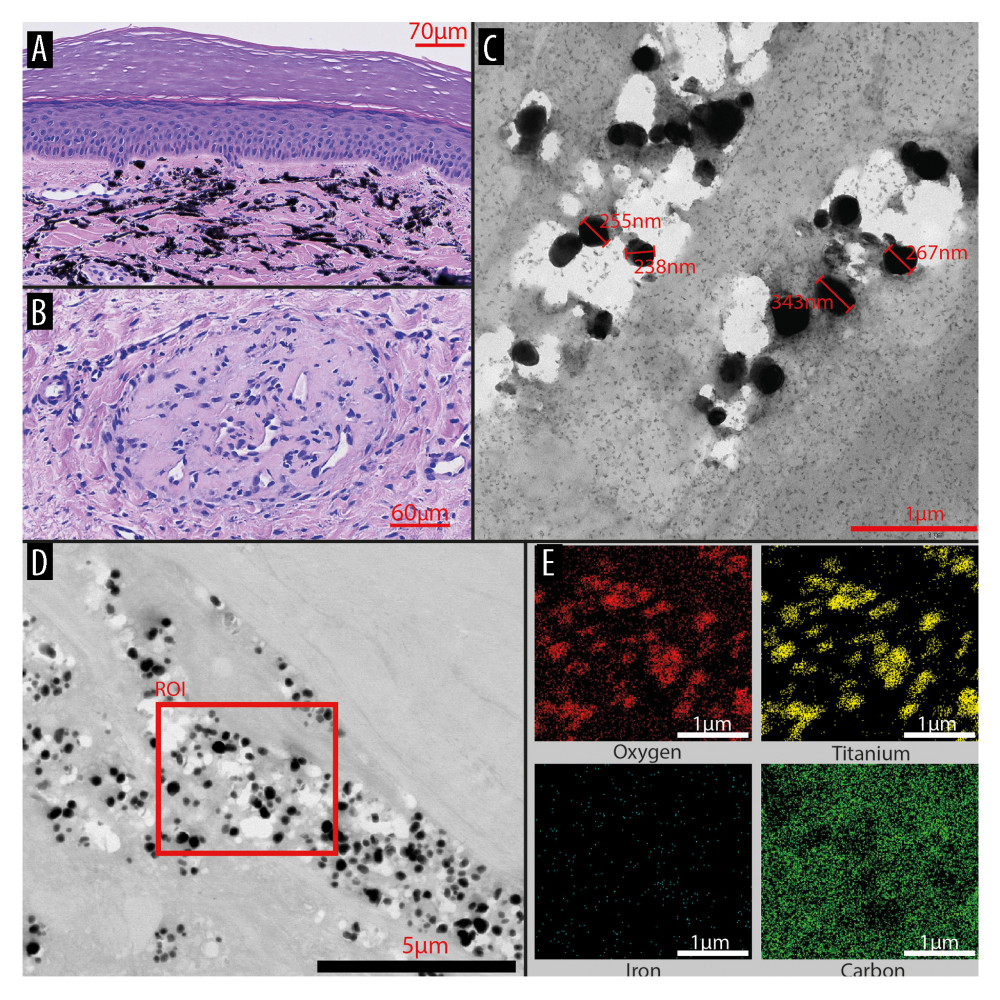 American Journal of Case Reports | Unveiling the Temporal Aspect of MRI ...