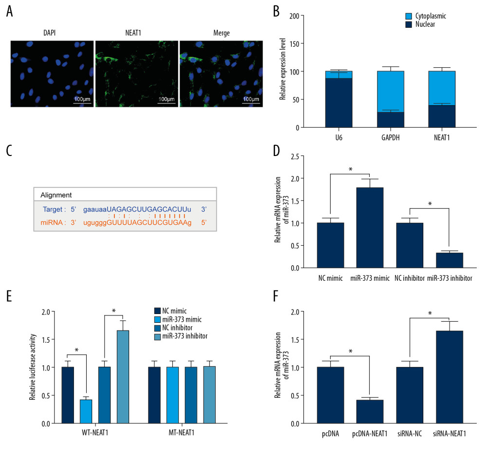Medical Science Monitor | Long Non-Coding RNA Nuclear-Enriched Abundant ...
