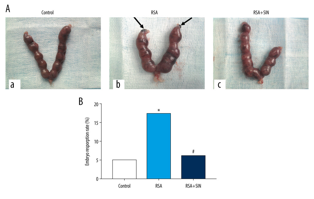 Medical Science Monitor | Sinomenine Improves Embryo Survival by ...