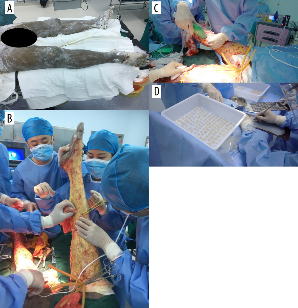 Medical Science Monitor | Retrospective Study from a Single Center on ...