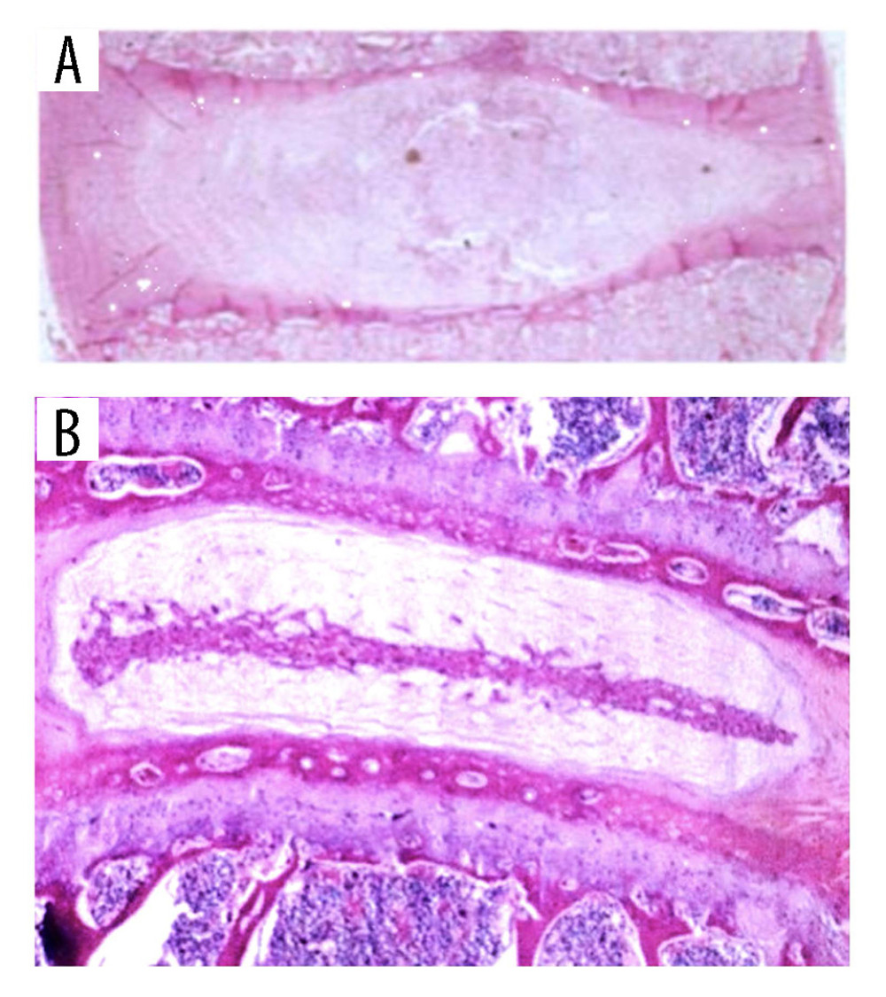 Intervertebral Disc Histology Animal Models To Study Spinal