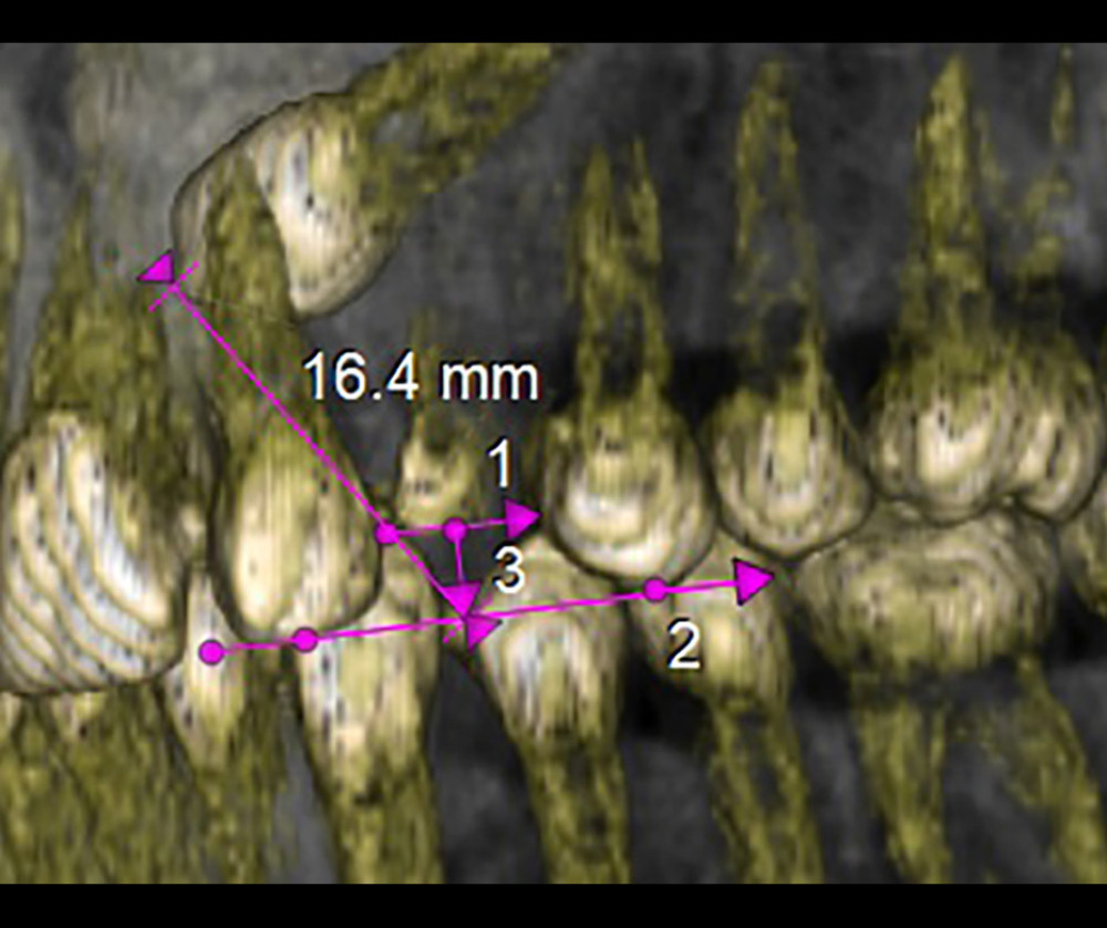 Medical Science Monitor | Comparative Analysis of Morphological ...