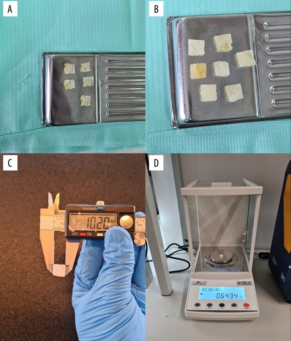 Medical Science Monitor | Edible Bite Force Sensor: A Novel Approach to ...