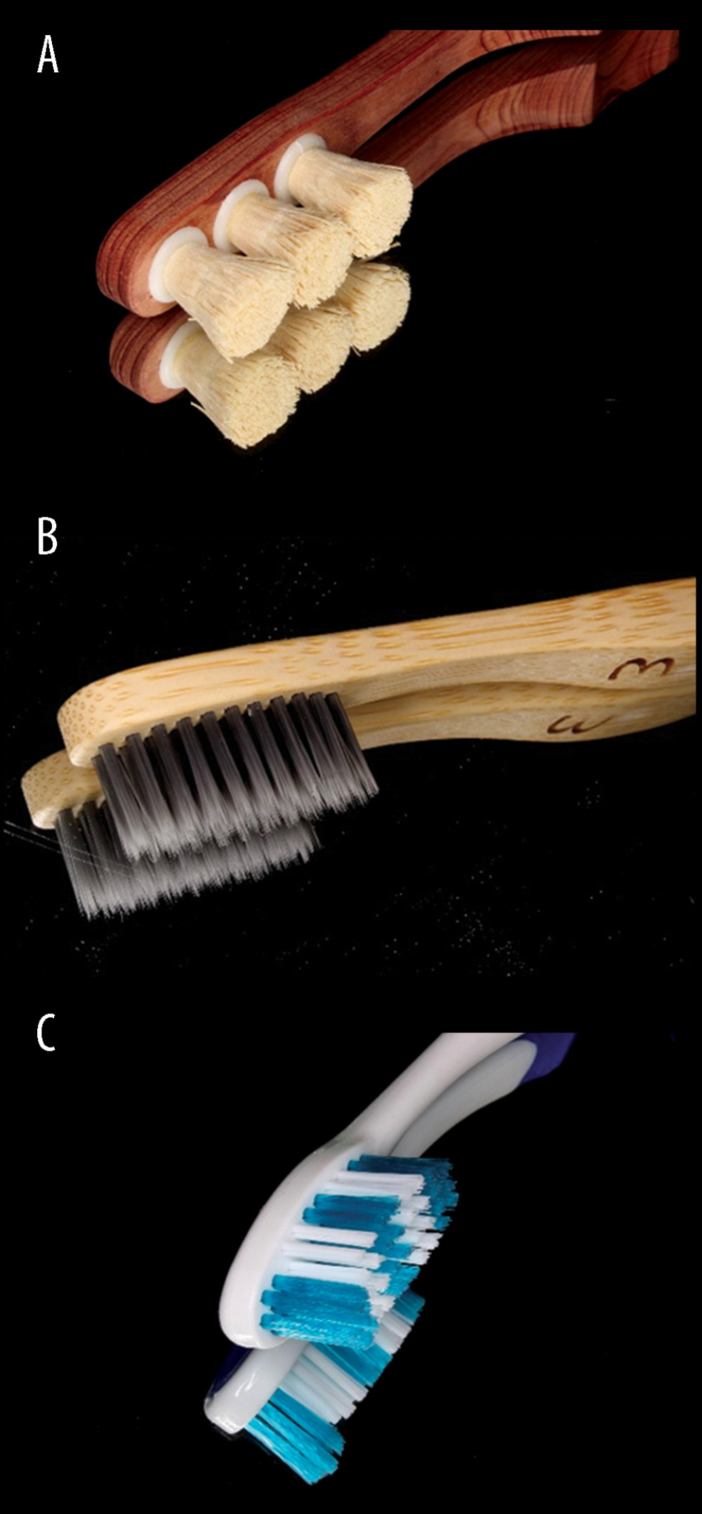 Medical Science Monitor | Plaque Removal and Gingival Bleeding Using ...