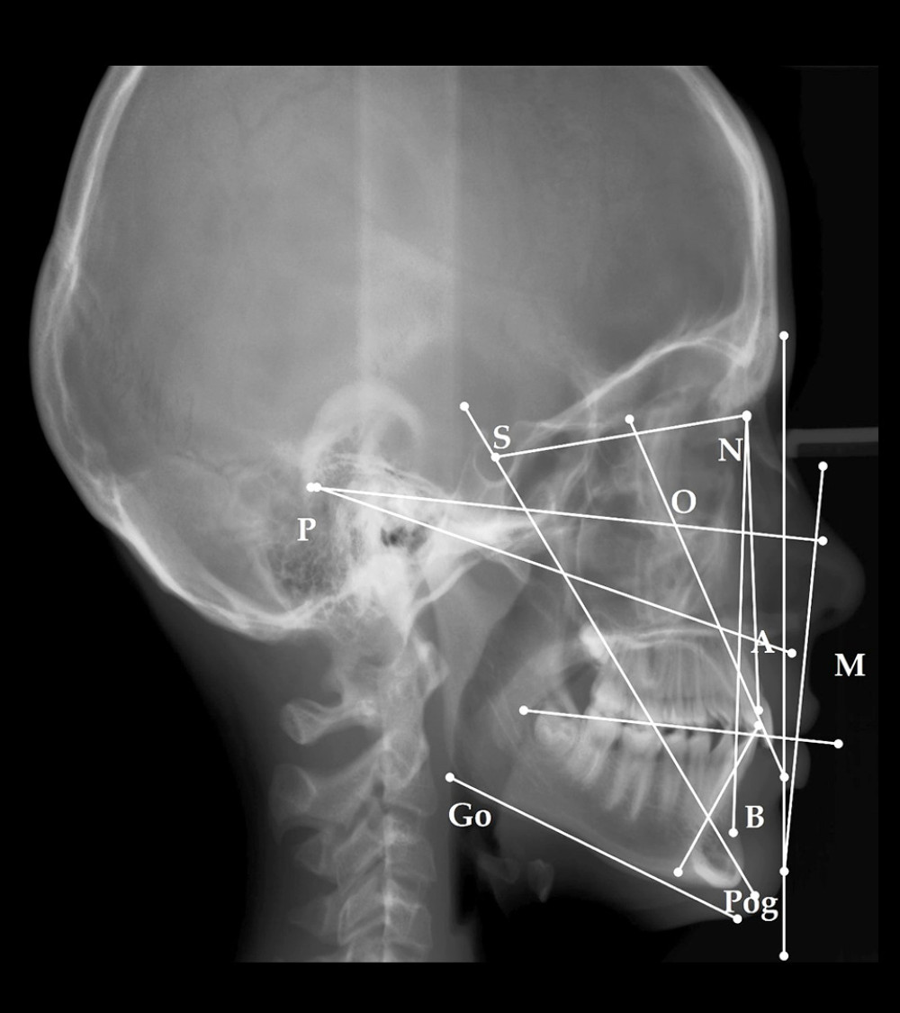 Medical Science Monitor | Comparative Evaluation of Digital ...